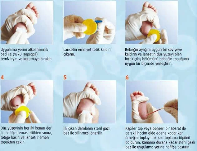 Topuk kanı bebeklerin ayaklarındaki "üreme noktalarından" mı alınıyor ...